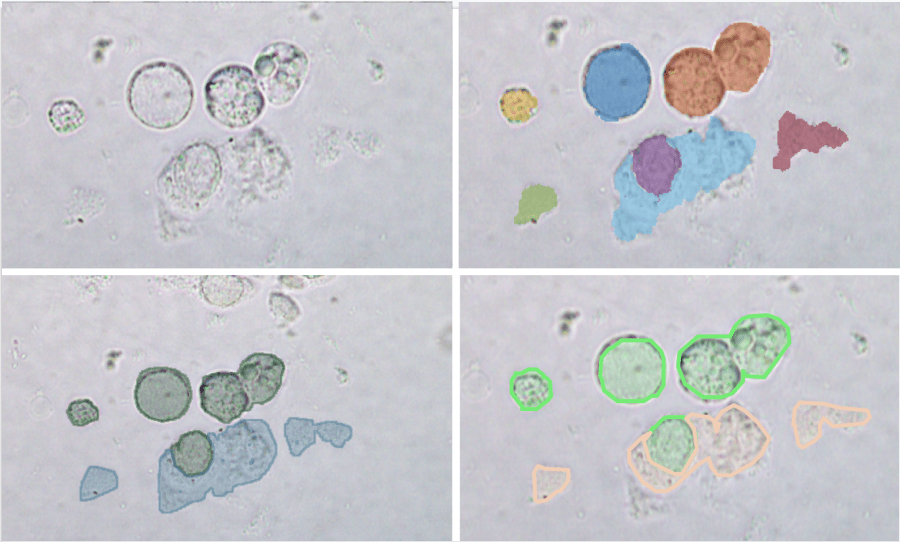 Find The Best Image Segmentation Tool